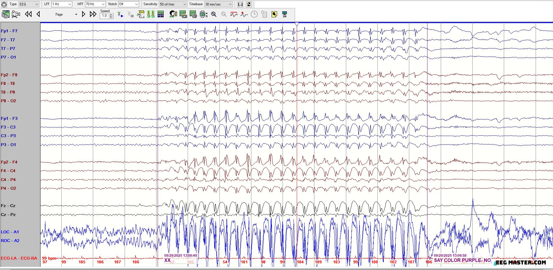 EEG Master- learn EEG
