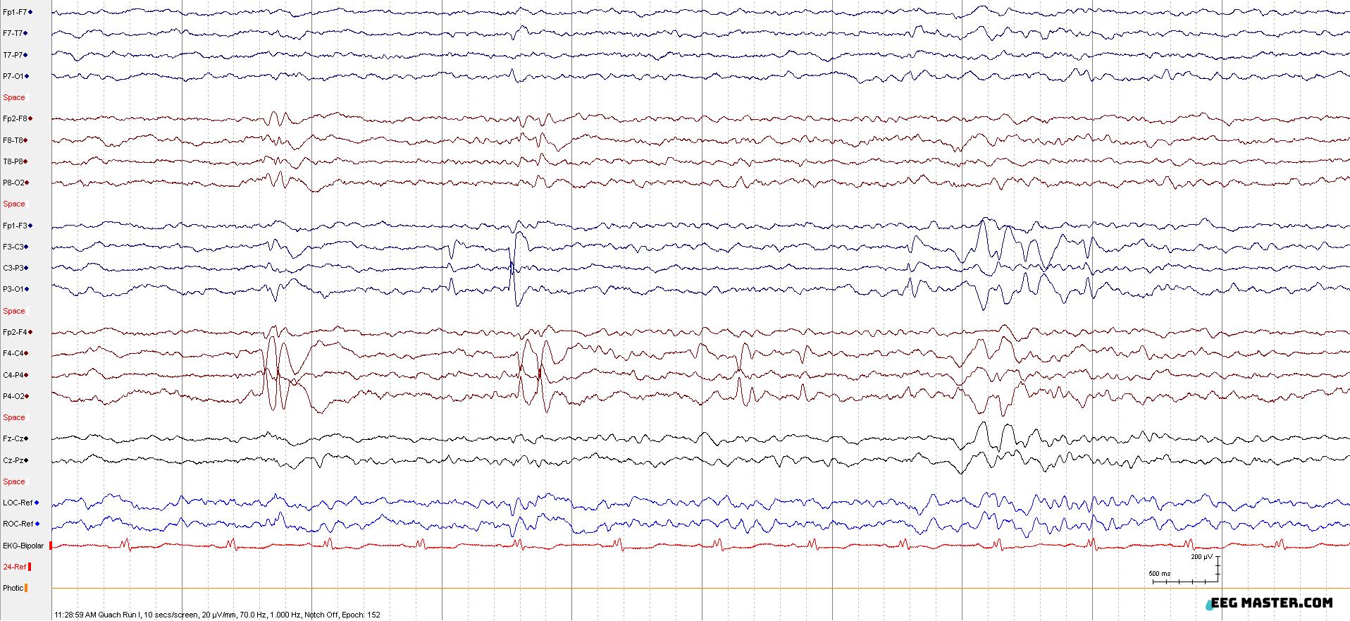 EEG Master- learn EEG
